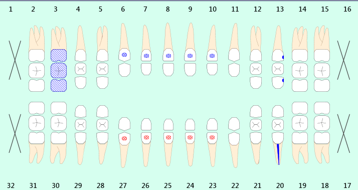 NextGen® Electronic Dental Record – Documentation Basics